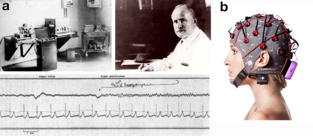 Interfaces cerebro-máquina: historia, avances y desafíos – Instituto ...